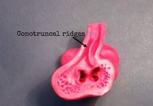 عضله قلب طی زمان ها و مراحل مختلفی از یک لوله ساده به یک ساختار عضلانی ...