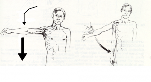 تست های ارتوپدی شانه و بررسی مشکلات مفاصل، رباط ها، تاندون ها، بافت های ...